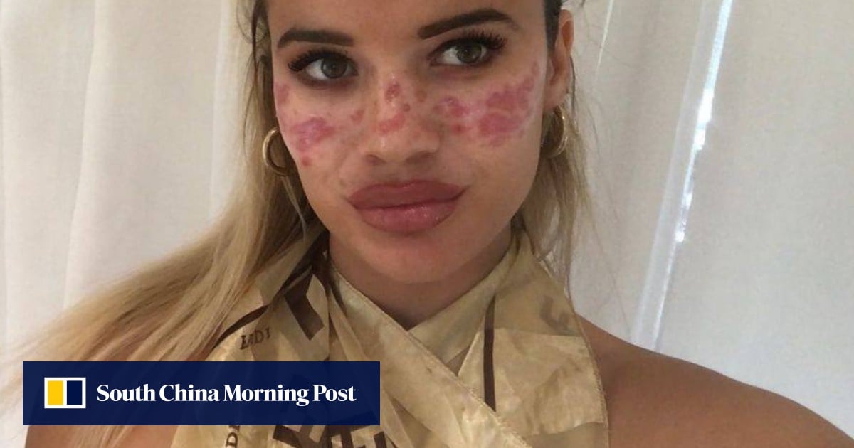 The Worst Viral Beauty Trends On Tiktok And Why You Should Avoid Them