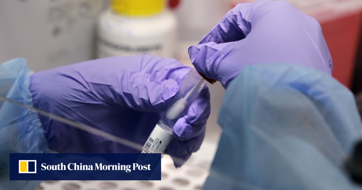 US detects first case of Omicron coronavirus variant | South China Morning Post