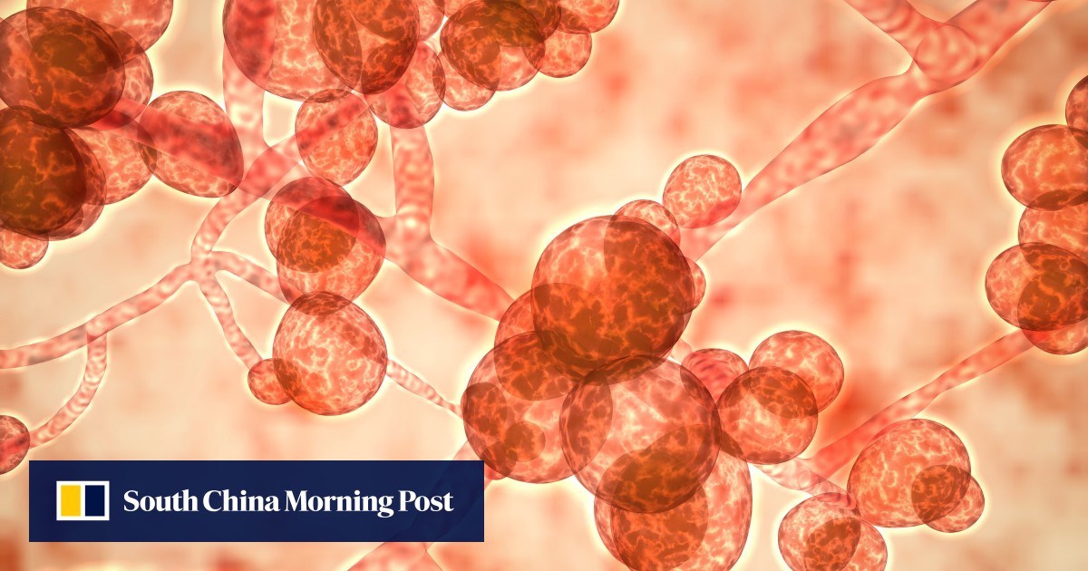 Antibiotic-resistant superbugs killed more than 1.2 million people in ...