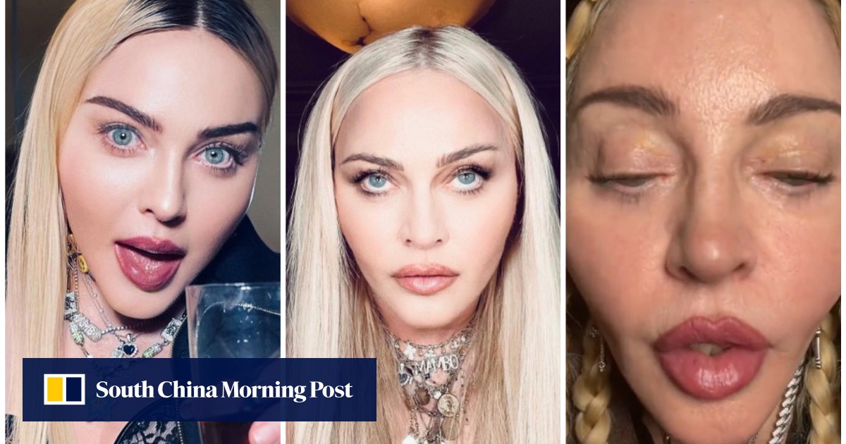 Filters Or Fillers Madonnas Shock New Look And Transformation Over
