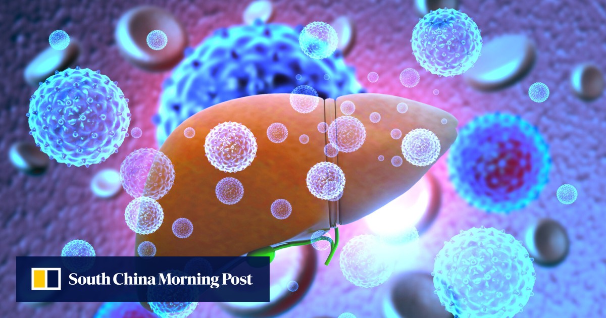 Singapore confirms case of acute hepatitis in 10-month old baby | South ...