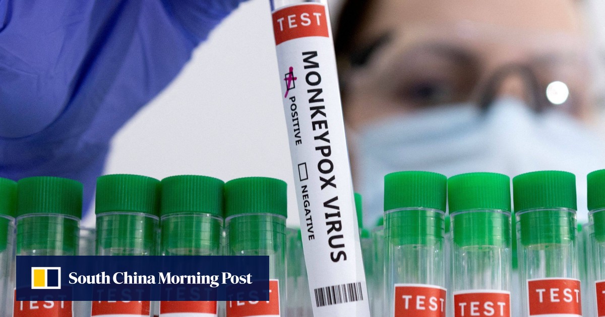 Monkeypox test kits developed by Swiss pharmaceutical giant Roche ...