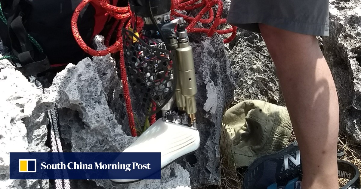 How cutting-edge ‘robotic’ prosthetics developed for amputees could ...