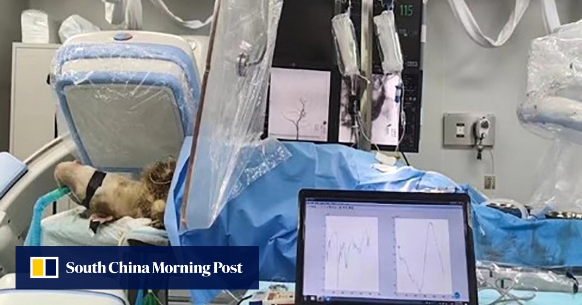 Chinese team implants brain sensor without cracking skull | South China ...