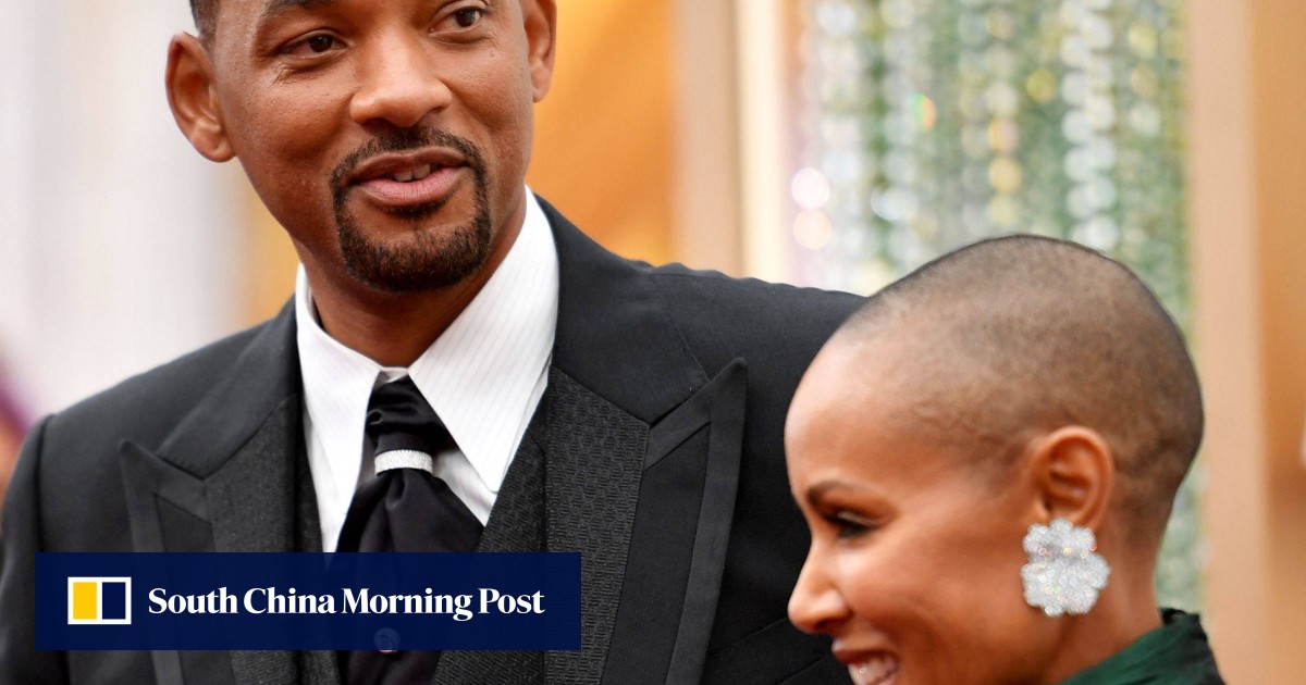 Alopecia areata, Jada Pinkett Smith’s hair-loss condition, now ...