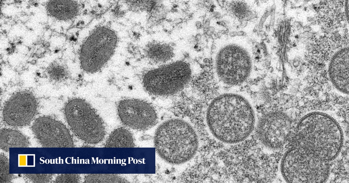 China steps up monkeypox procedures, calling on travellers to announce ...