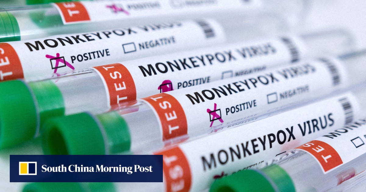 Philippines detects first case of monkeypox | South China Morning Post