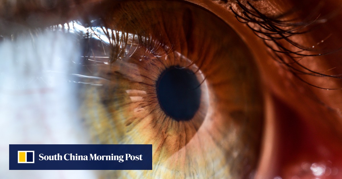 Depression and dementia may be treatable using eye stimulation therapy ...