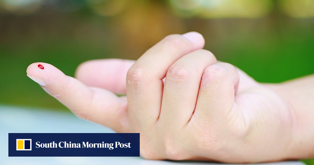 ‘It’s Theranos that works’: how a finger-prick blood test could reveal ...