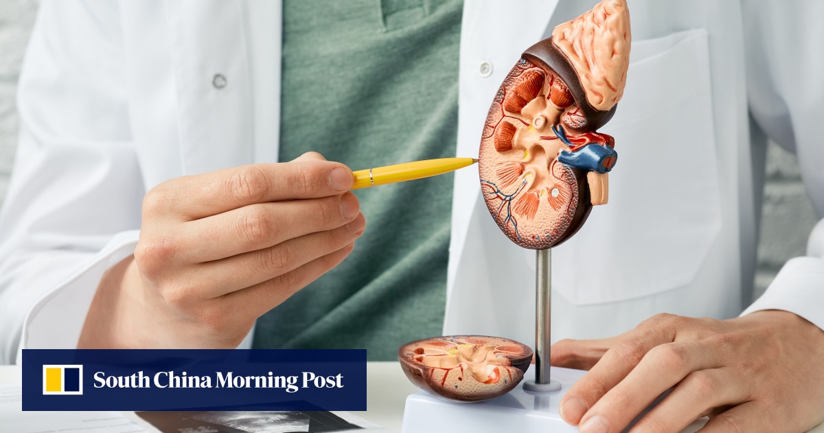 How to protect yourself against chronic kidney disease, a silent killer ...