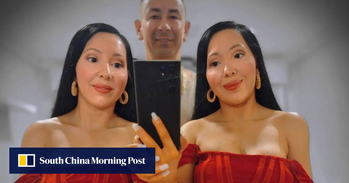 ‘Most identical’ Australian twins share everything – even a fiancé ...