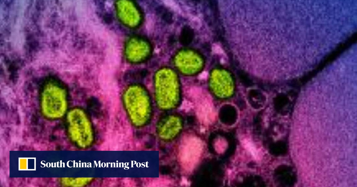 Hong Kong authorities confirm fourth case of monkeypox 1 day after ...