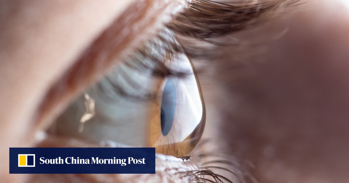 Eyes front: university finds Hong Kong has highest levels of vision ...