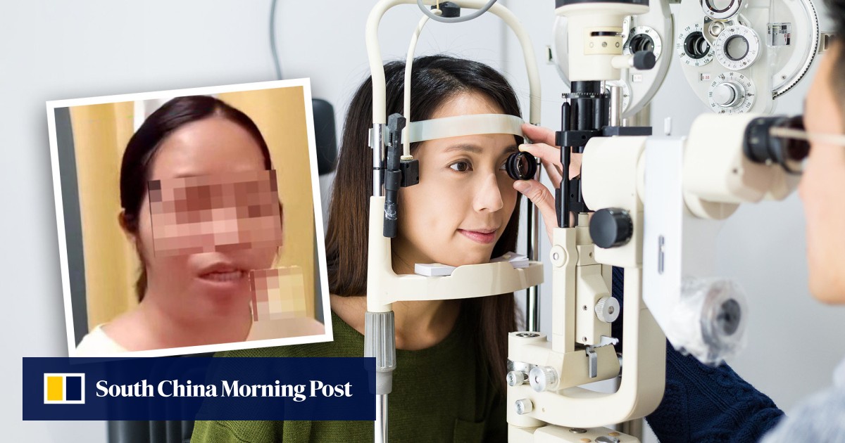 ‘You still have one eye’: fury as partially blind Chinese woman told ...