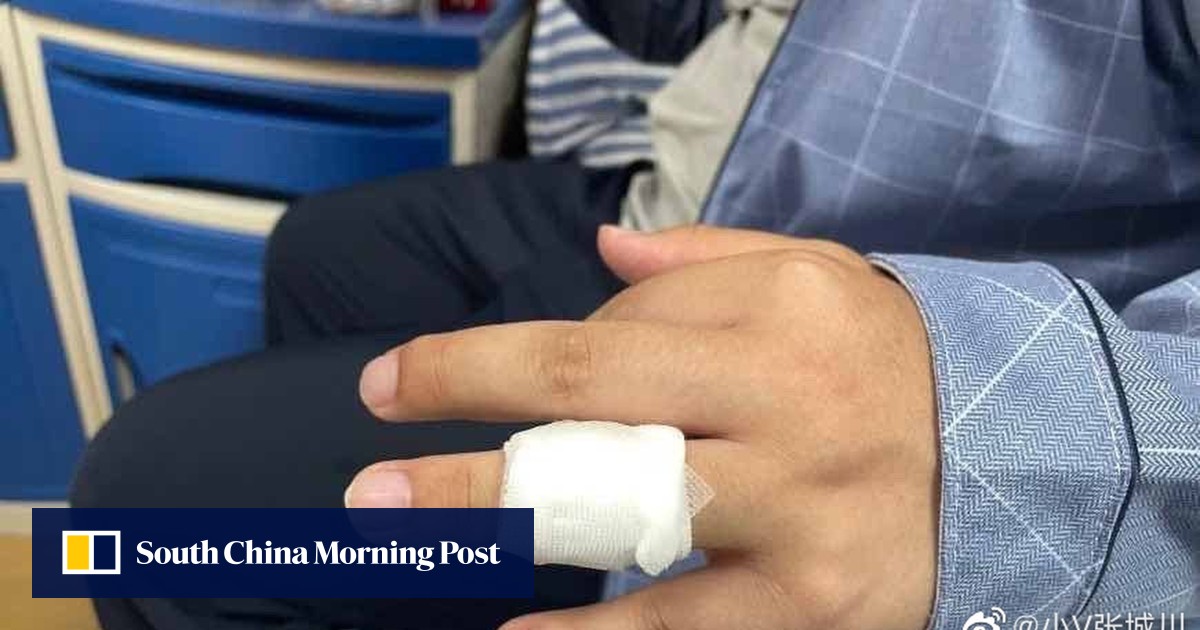 Police attack on reporter sparks rare public debate, outrage in China ...