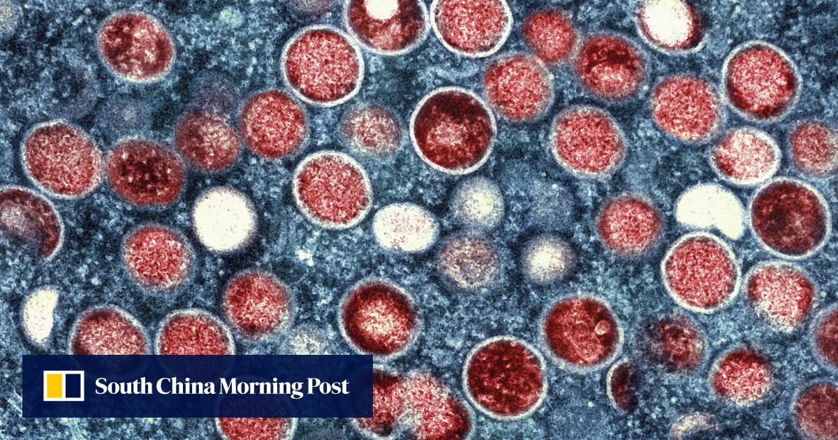 Hong Kong to open mpox vaccination centre on Thursday, as authorities ...