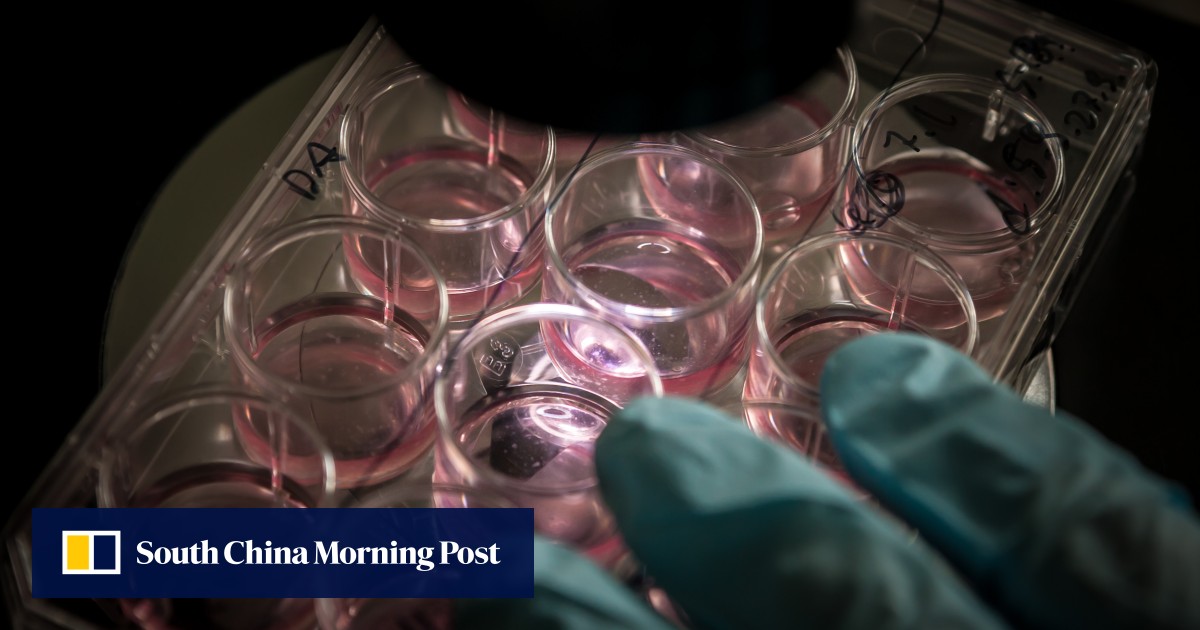 Scientists create human embryo models without sperm or egg | South ...