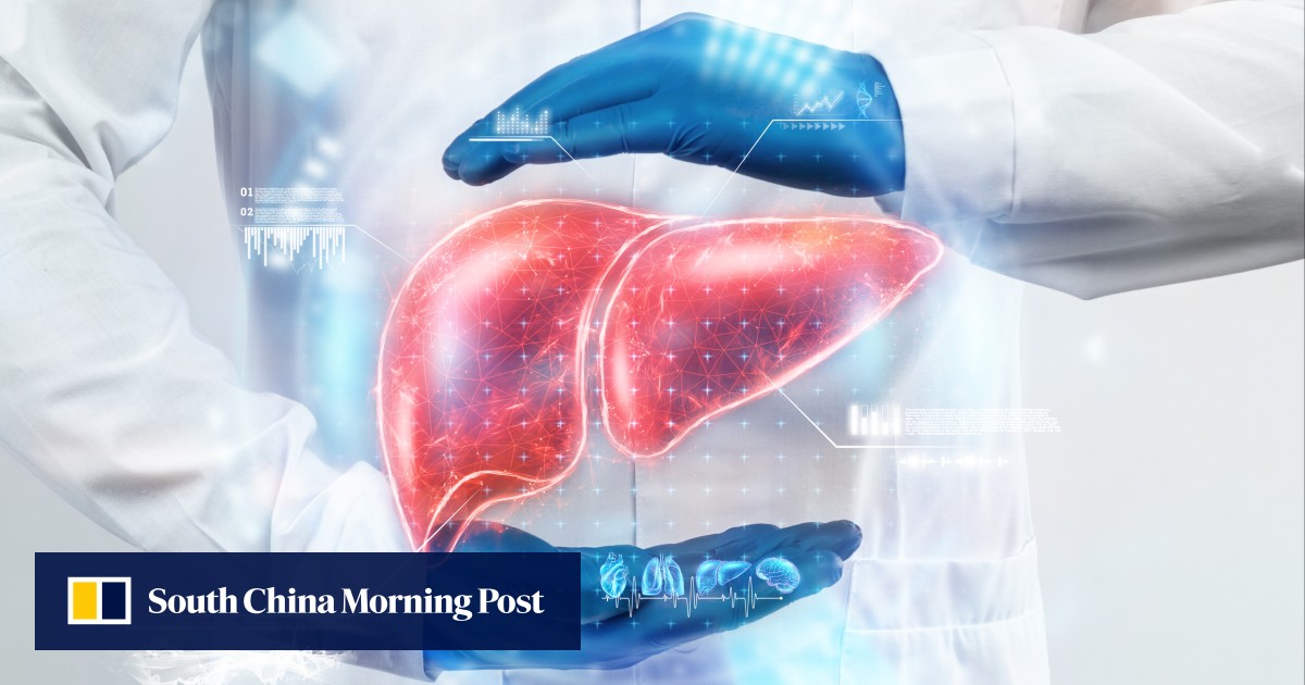 Is China’s man-made liver therapy a game-changer for millions battling ...