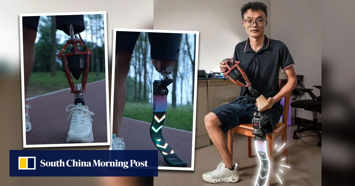 ‘I control my life’: China amputee with blinking prosthetic leg ...