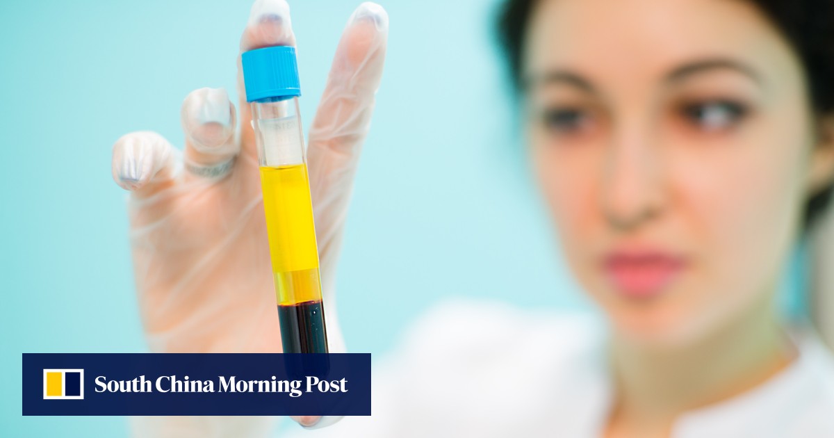 At risk for Alzheimer’s disease? 2 new blood tests could detect it ... At risk for Alzheimer’s disease? 2 new blood tests could detect it ...