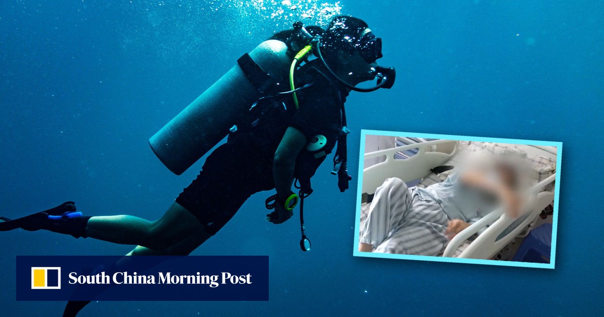 No heartbeat for 4 minutes: thrill-seeking China diver wakes from month ...