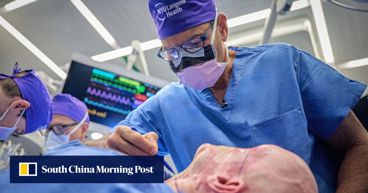 US surgeons perform world’s first whole eye transplant | South China ...