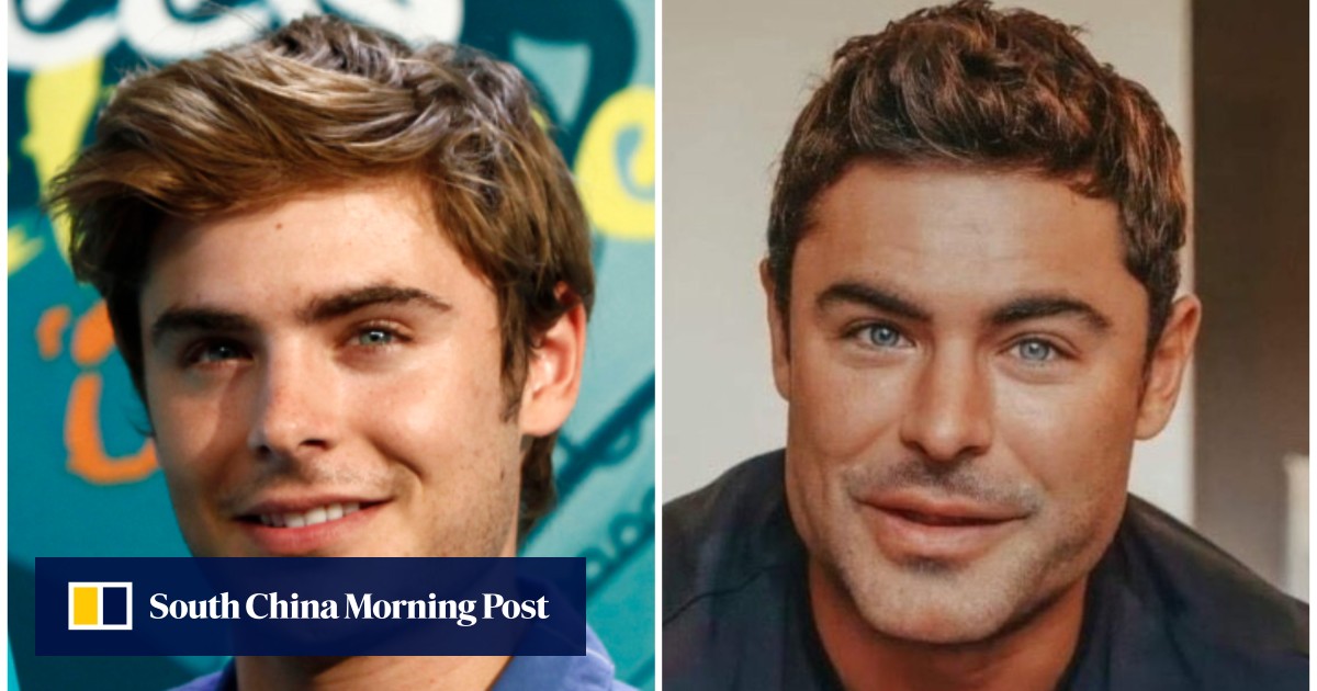 What happened to Zac Efron’s jaw? The Iron Claw actor just set the ...