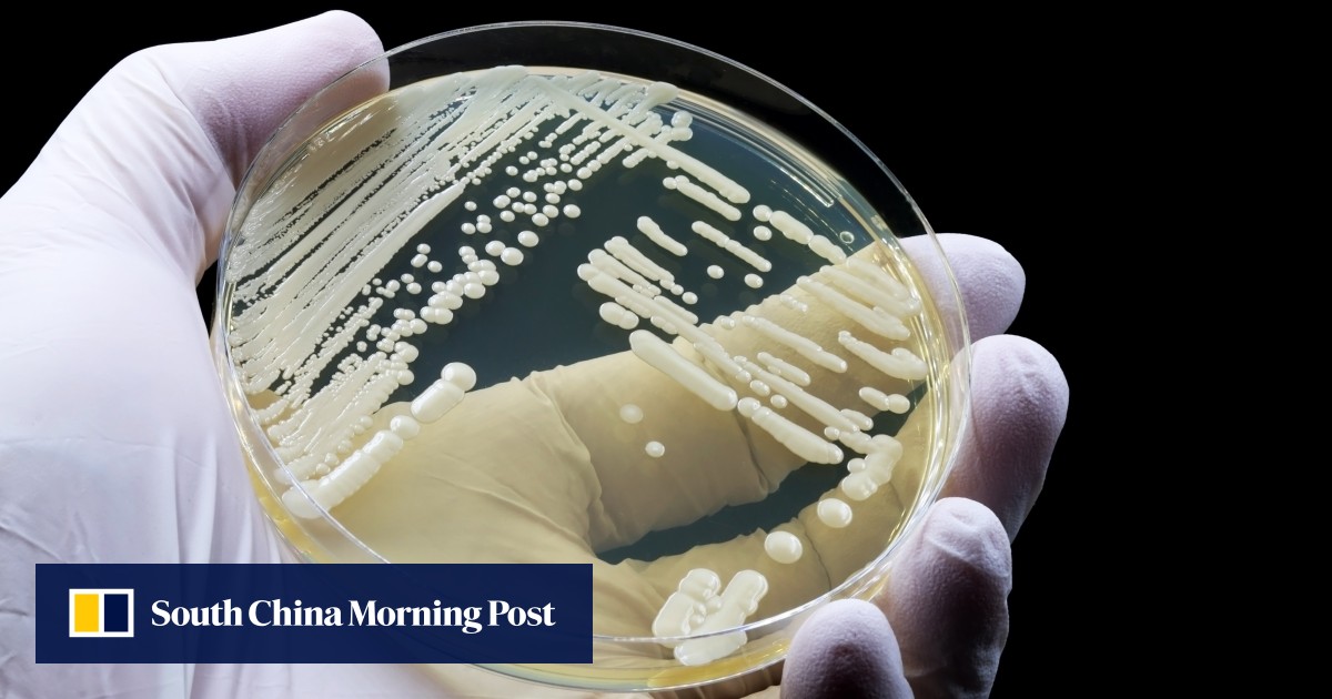 Hong Kong Hospital Authority warns of surge in 2 superbugs, turns to AI ...