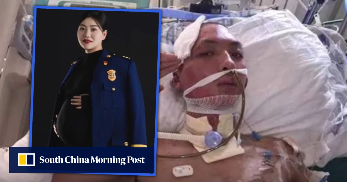 ‘He loves us most’: girlfriend of brave firefighter with 90% burns and ...