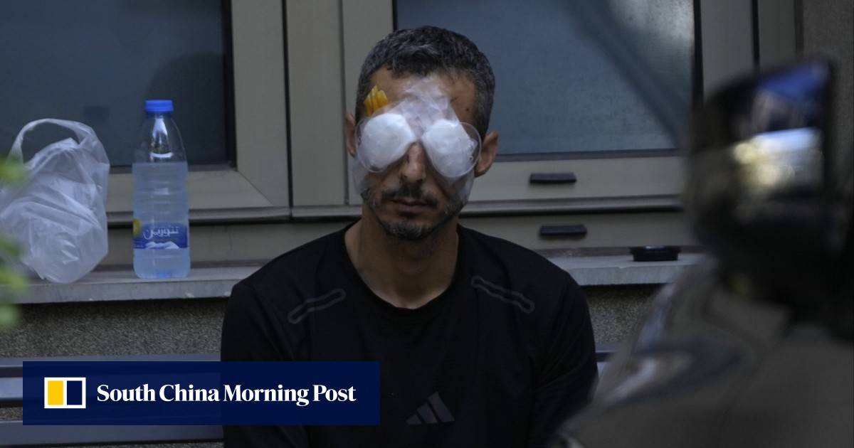 Doctor races to save eyes of those hurt by Lebanon pager and walkie ...