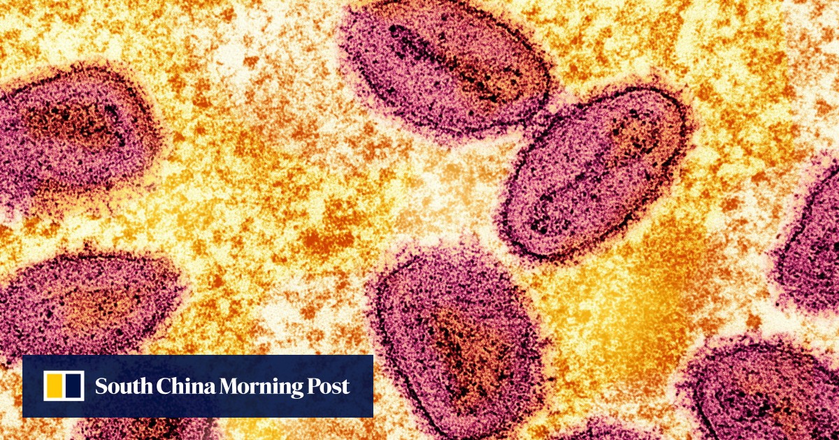 WHO approves first mpox diagnostic test for emergency use | South China ...