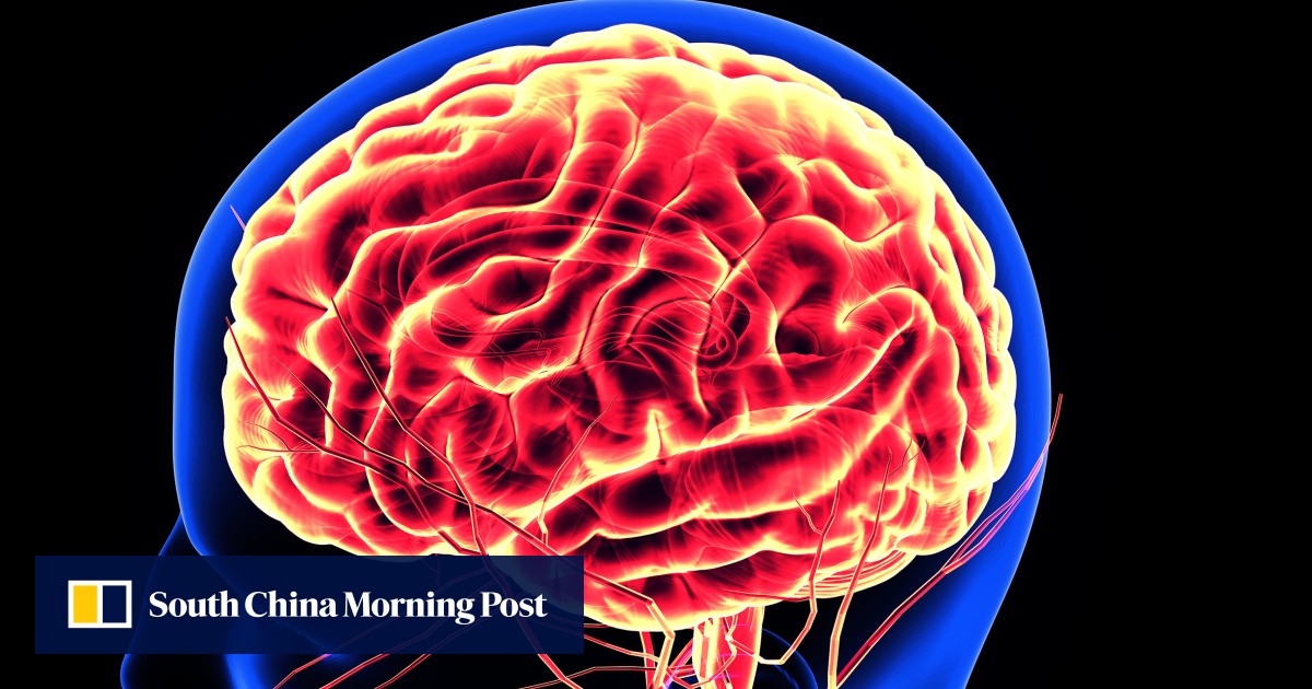 China-led study that restarted pig’s brain offers hope for heart attack ...