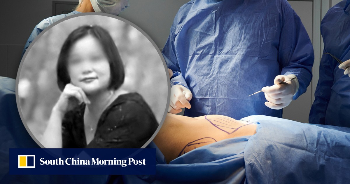 China woman dies after 6 cosmetic surgeries in a day, family gets half ...