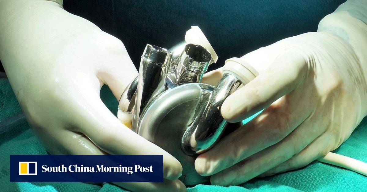 Australian man survives for 105 days with titanium heart in world first ...