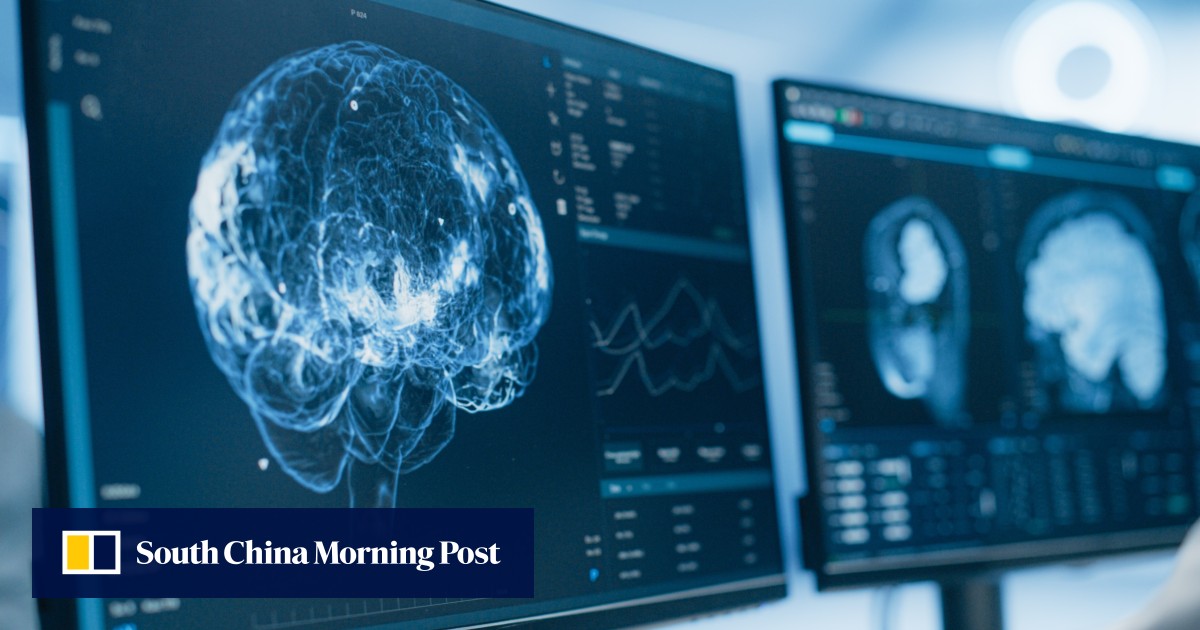 Mapping the mind: Chinese and French scientists advance on neural ...