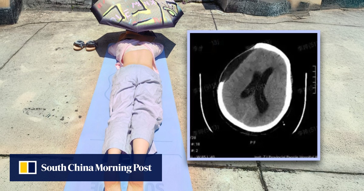China woman suffers brain haemorrhage, in coma after sunbathing to ...