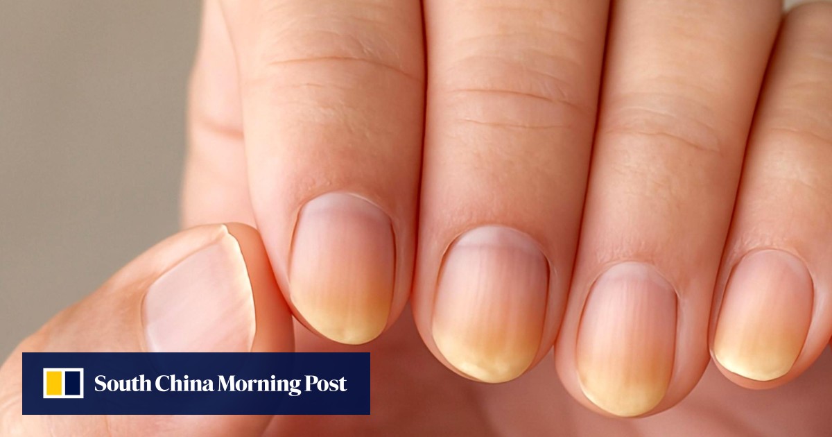 What do nails say about your health? Experts reveal what to look for ...