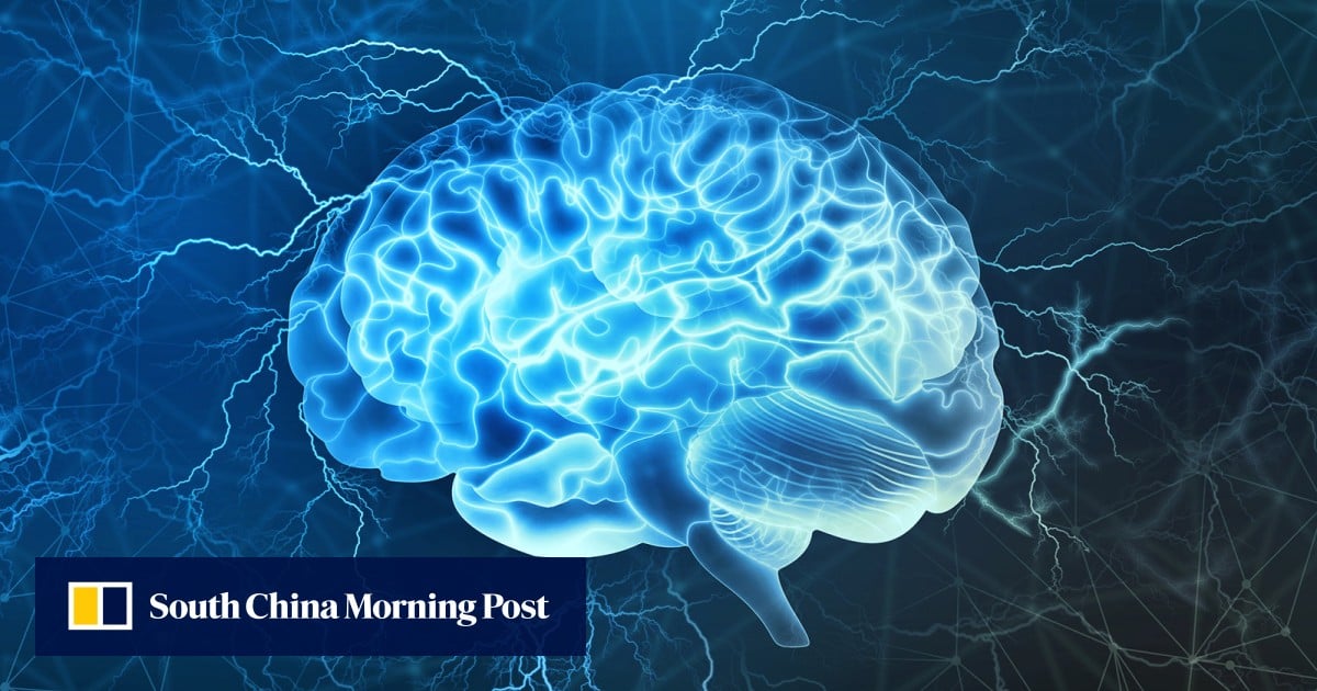 Soft brain chip could help solve Neuralink’s big implant challenge ...