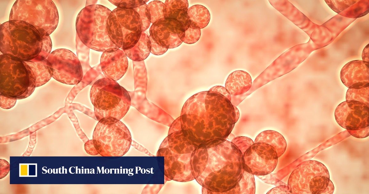 Hospital Authority strengthens control measures against superbug ...