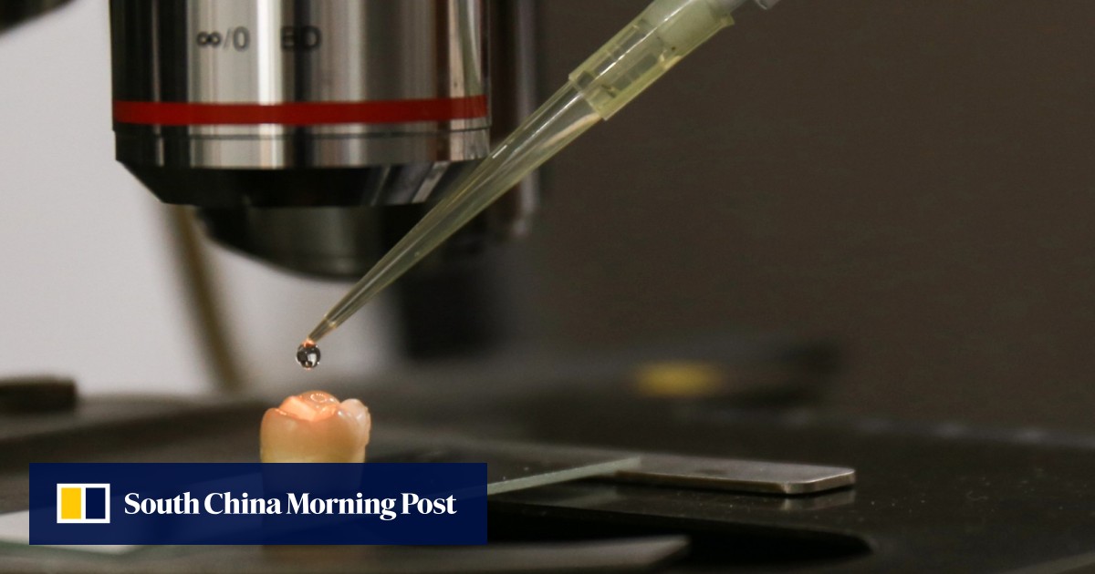 Chinese scientists ‘make first perfect replica’ of tooth enamel | South ...