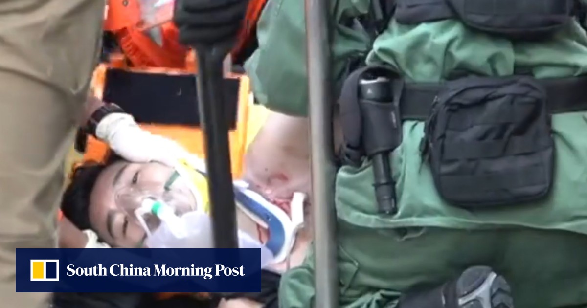 Secondary school student in stable condition after being shot with live ...