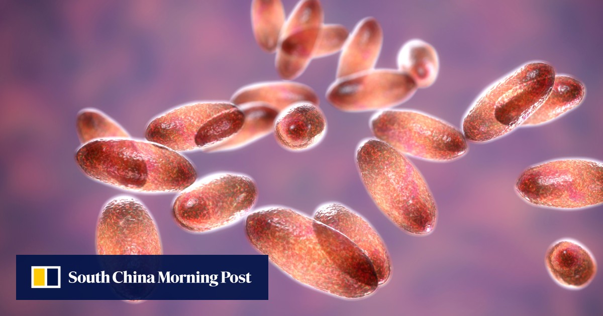 Two pneumonic plague cases confirmed in Chinese villagers | South China ... Two pneumonic plague cases confirmed in Chinese villagers | South China ...