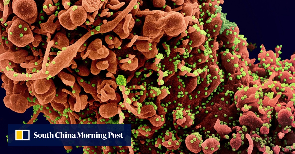 Research finds coronavirus in stool samples 22 days after onset of ...