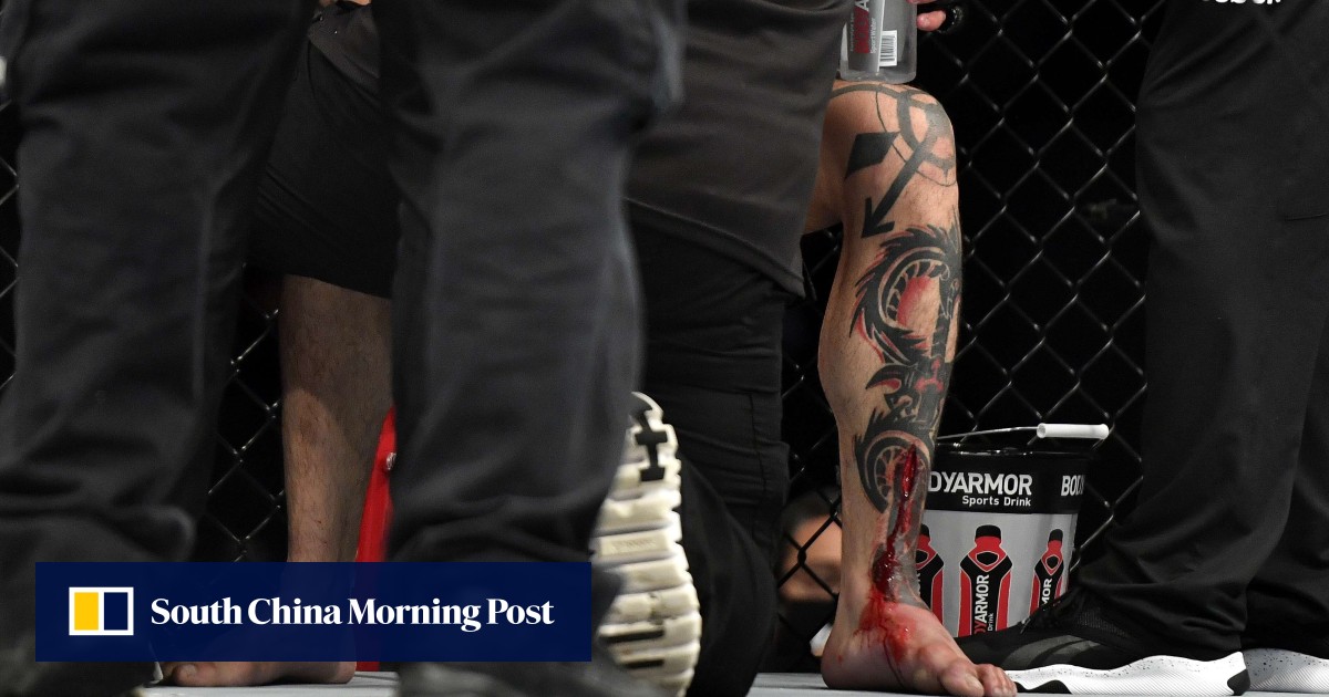 UFC: Gabriel Benitez suffers horrendous shin gash in decision loss ...