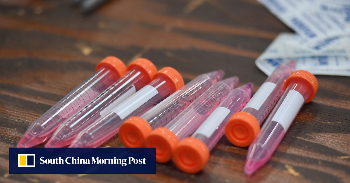 Coronavirus patient puzzles New York doctors with rare symptoms | South ...