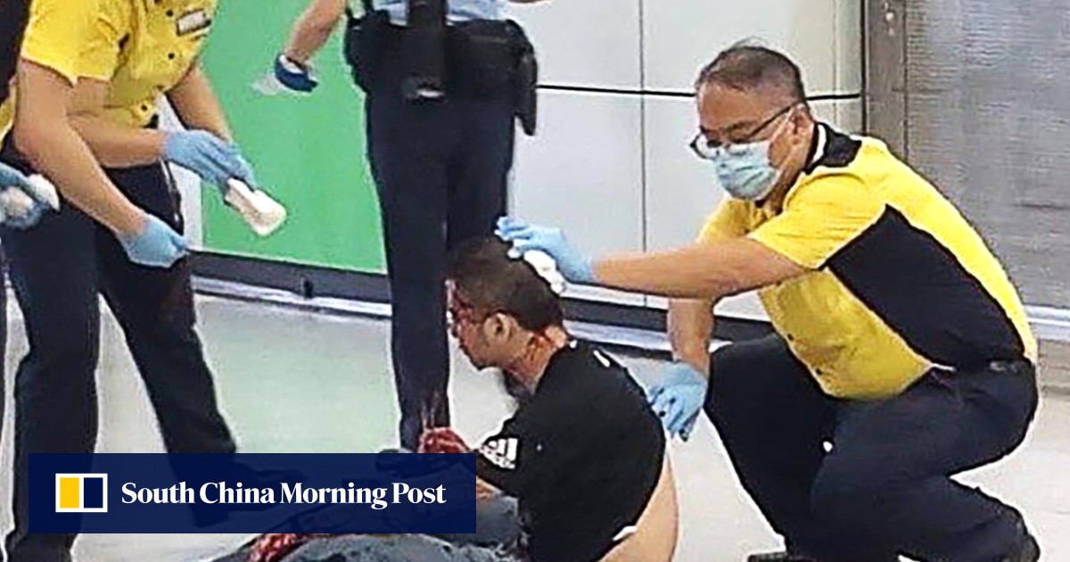Hong Kong police arrest two in Rolex robbery case that saw man slashed ...