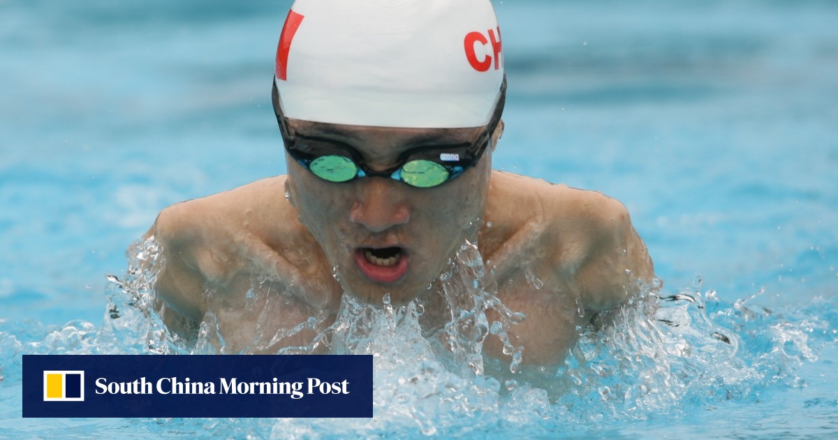 How to beat adversity: from losing both arms as a child to pro-athlete ...