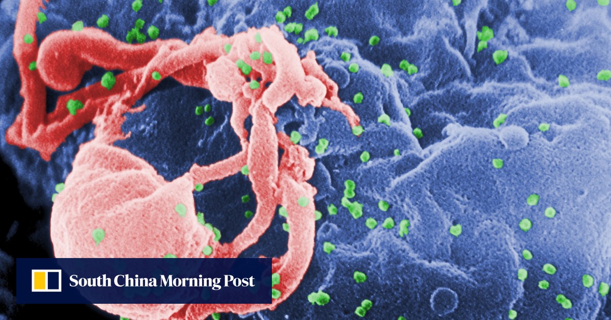 A woman’s immune system may have cured her of HIV. Scientists call her ...