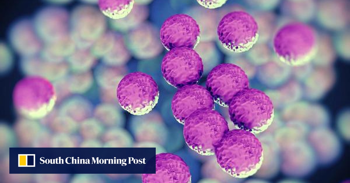 'Superbugs' could cost US$100 trillion and millions of lives globally ...