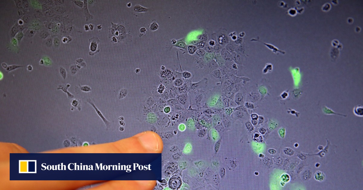 Alarming new ‘superbug’ gene resistant to last-resort antibiotics found ...